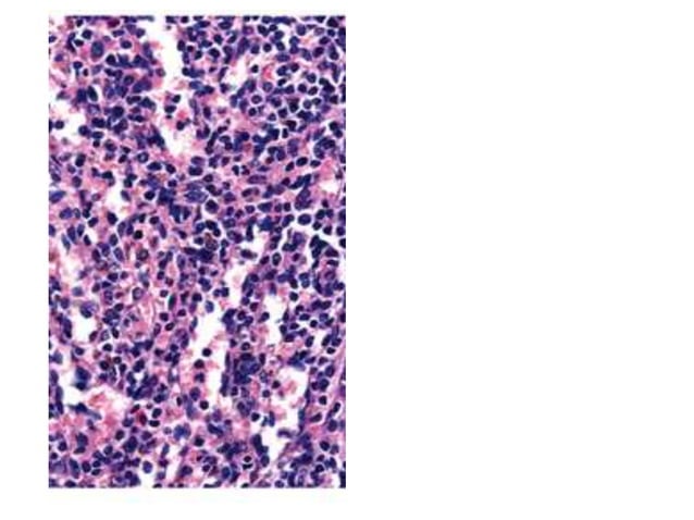 Lymphatic system easy lecture notes .ppt