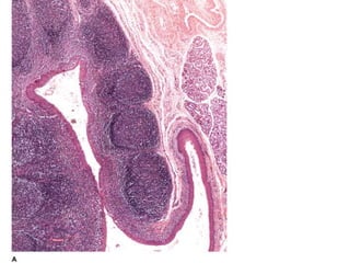 Lymphatic system easy lecture notes .ppt