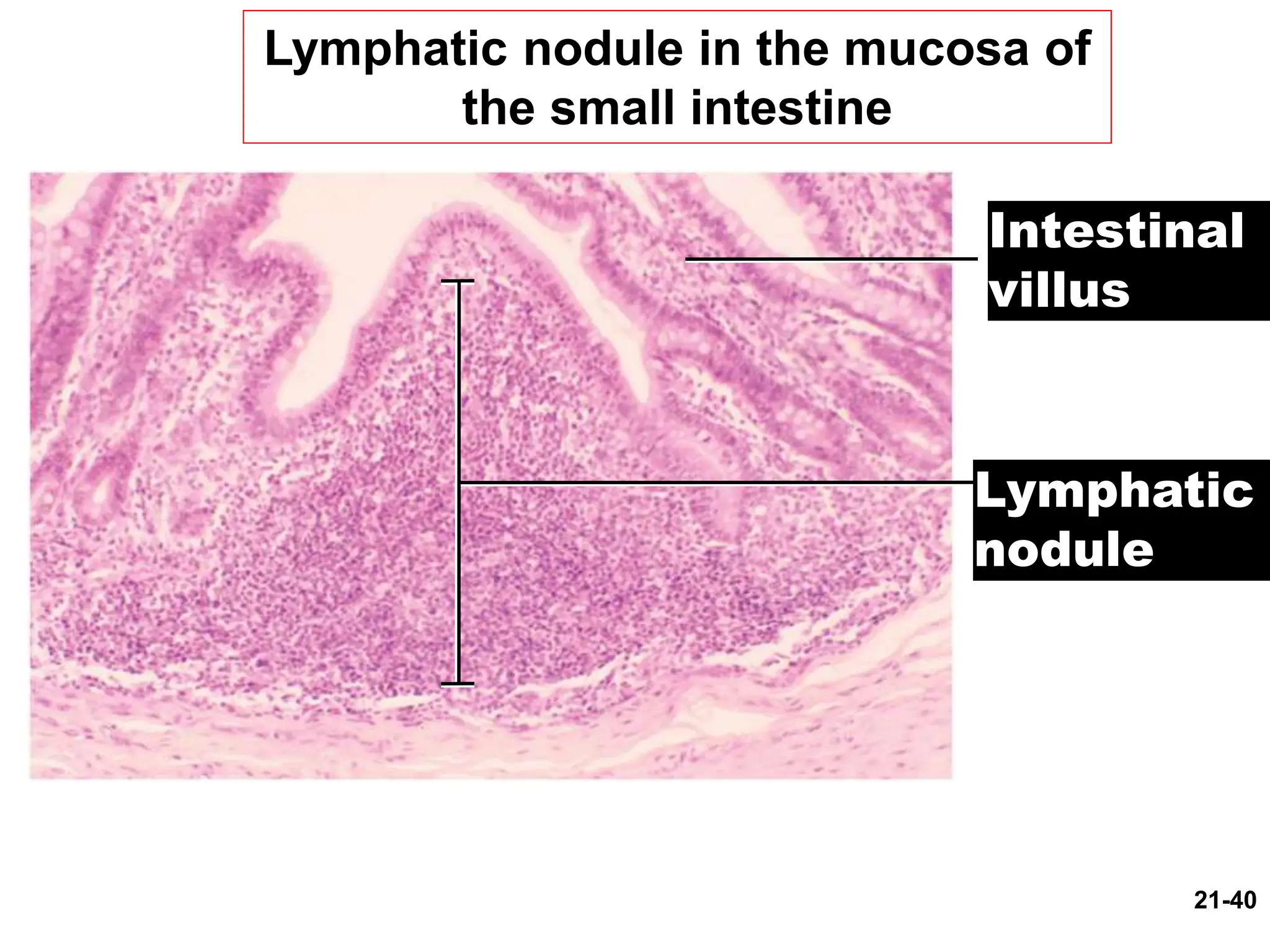 Anatomy of The lymphatic system of the human body. | PPTX
