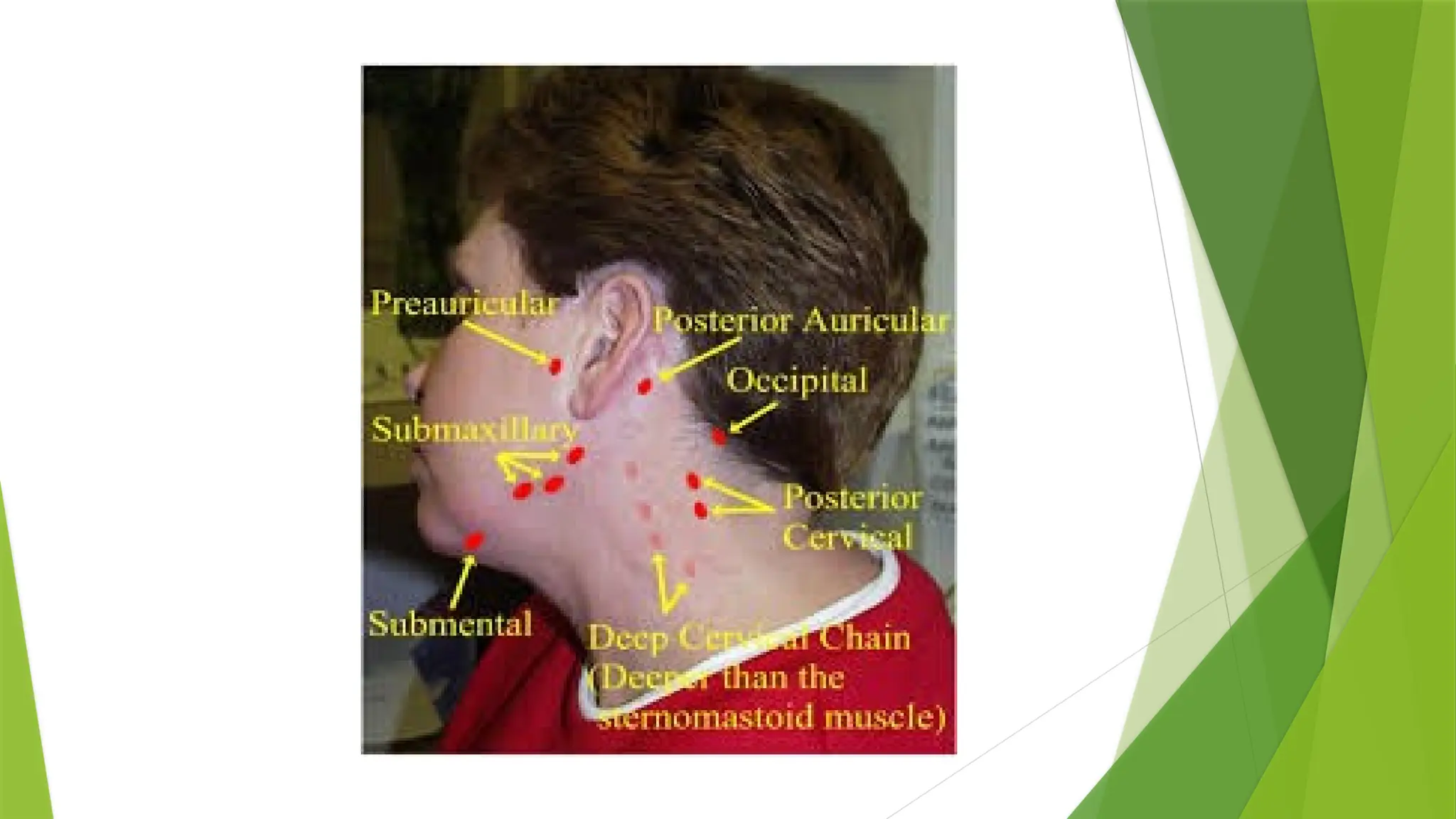 Lymphatic system of orofacial region 1st BDS.pptx