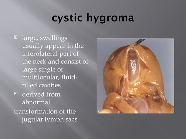 lymphatic system+ conducting system+ fetal , neonatal circulation.pptx