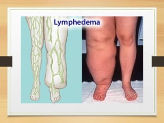 Lymphatic system ppt | PPT