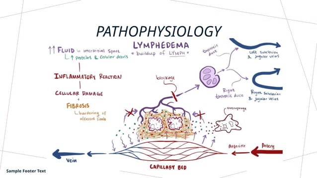 lymphedema, lymphangitis pathology .pptx