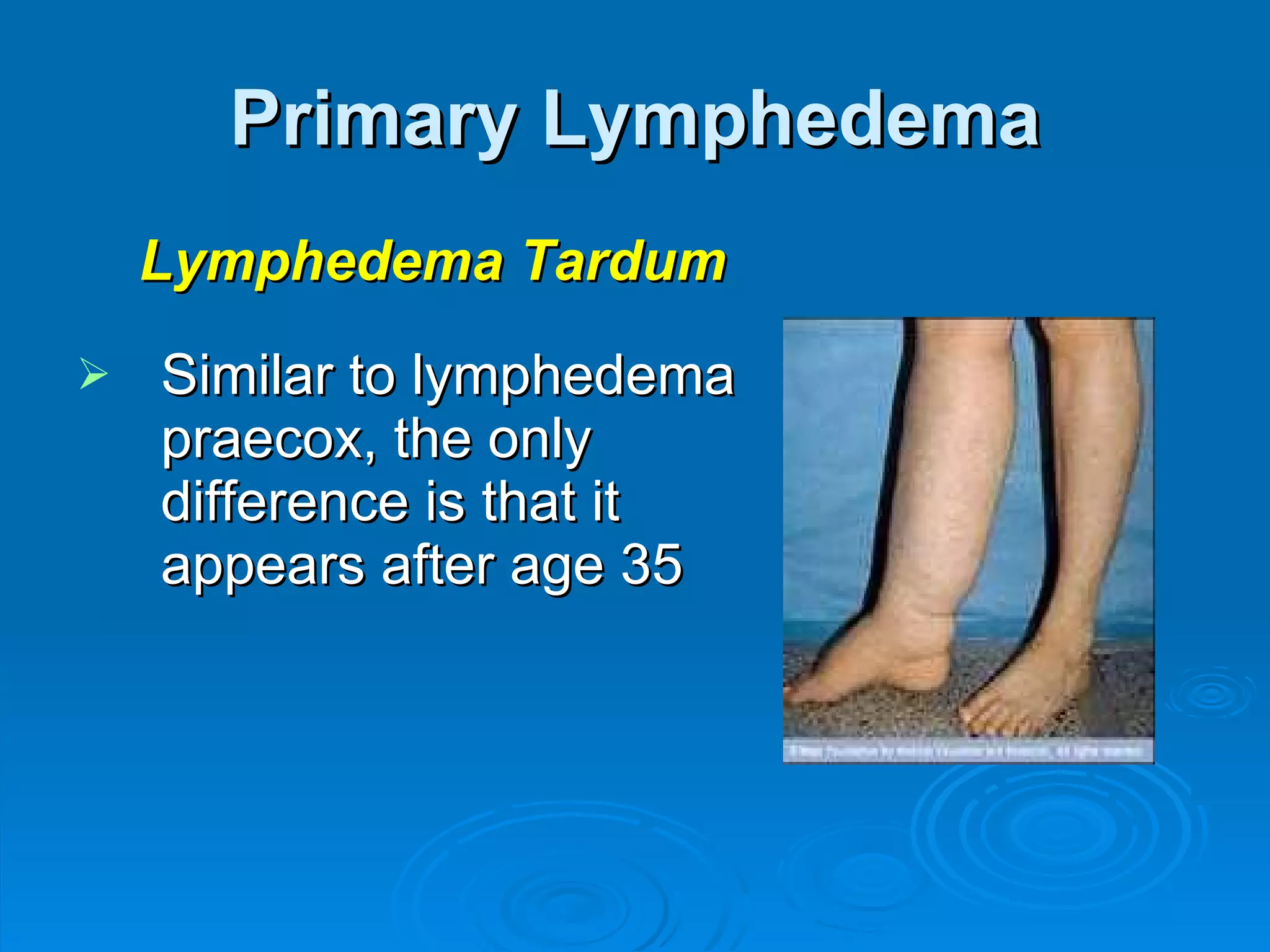 Lymphedema an overview | PPT