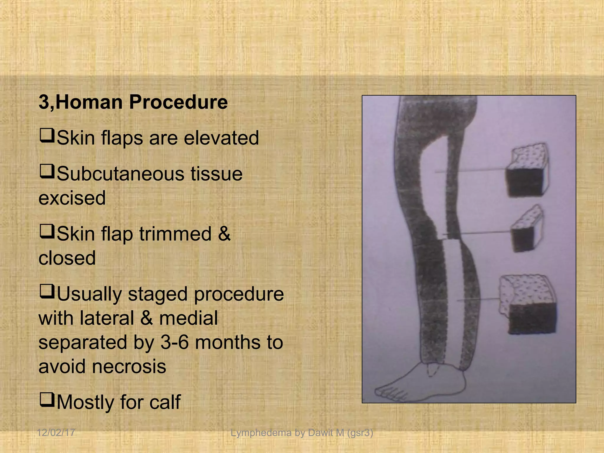 Lymphedema by Dr.dawit surgical resident@ Jimma university | PPT