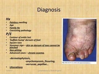 Lymphedema by Dr.dawit surgical resident@ Jimma university | PPT