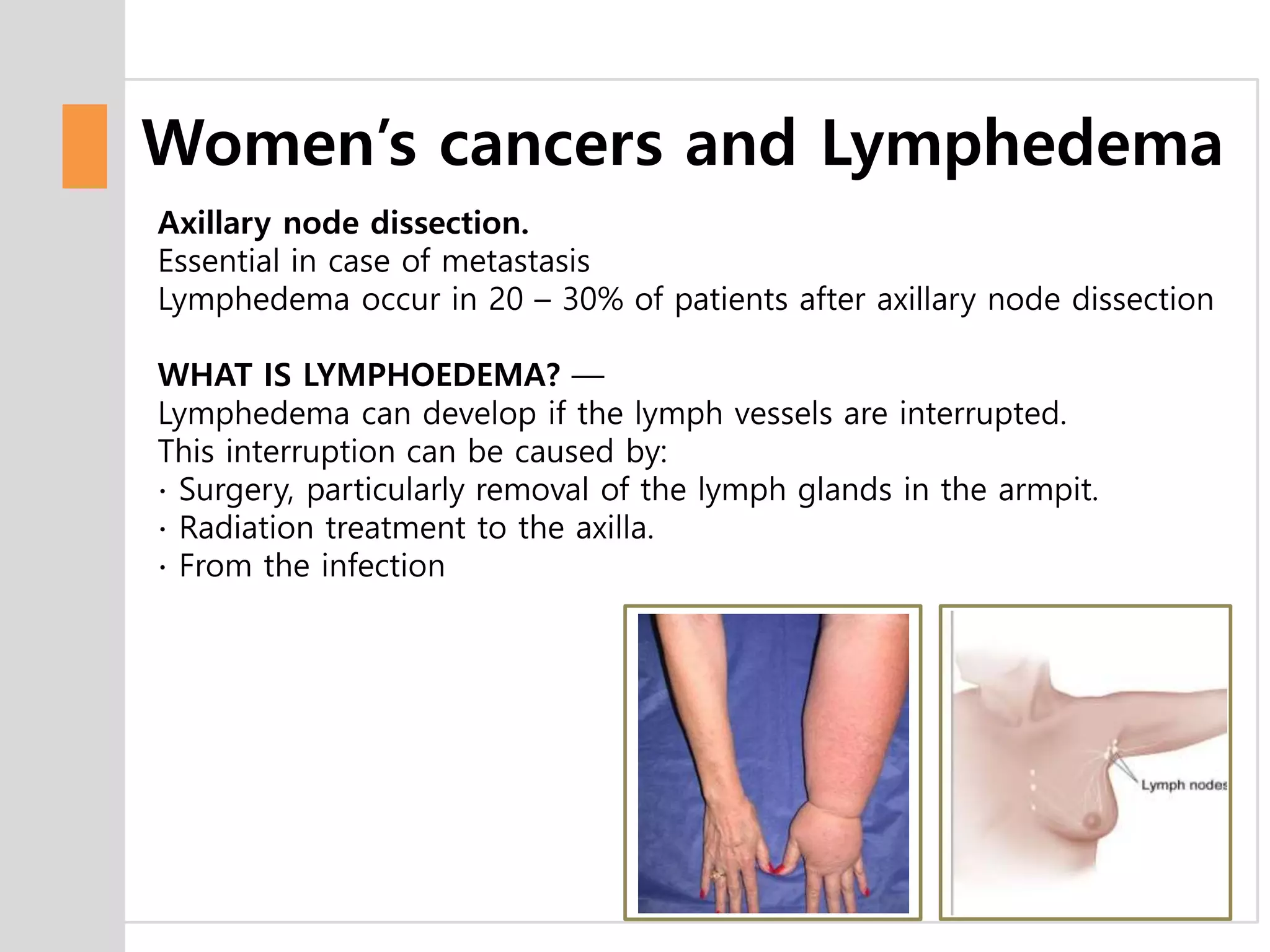 Lymphedema measurement using kinect volume reconstruction | PPTX | 3-D Graphics | Computer ...