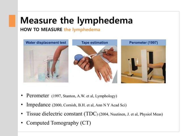 Lymphedema measurement using kinect volume reconstruction