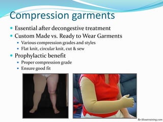 A preview of lymphedema treatment and management | PPTX