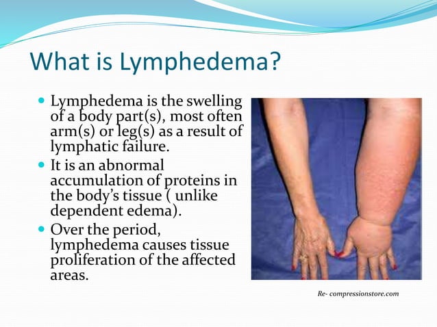 A preview of lymphedema treatment and management
