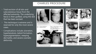 Lymphedema | PPTX