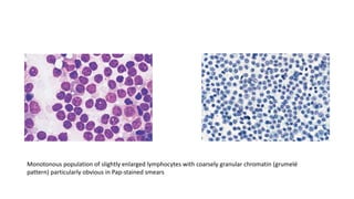 approach to lymph node cytology part 2 | PPTX