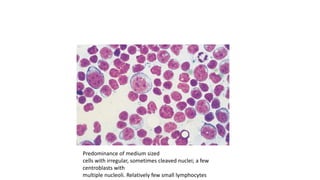 approach to lymph node cytology part 2 | PPTX