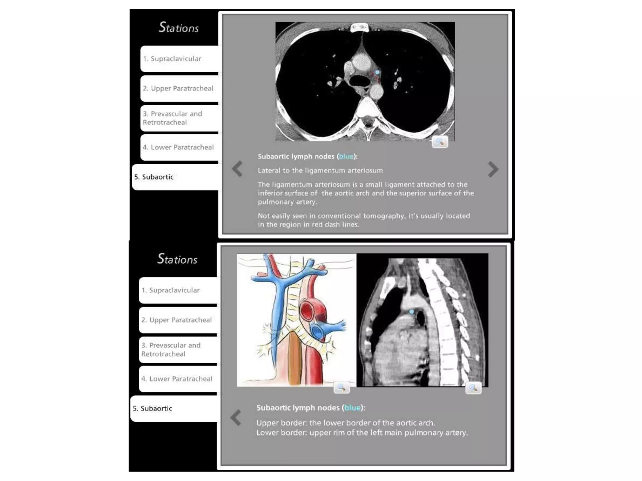 Lymph node anatomy for pet ct | PPT