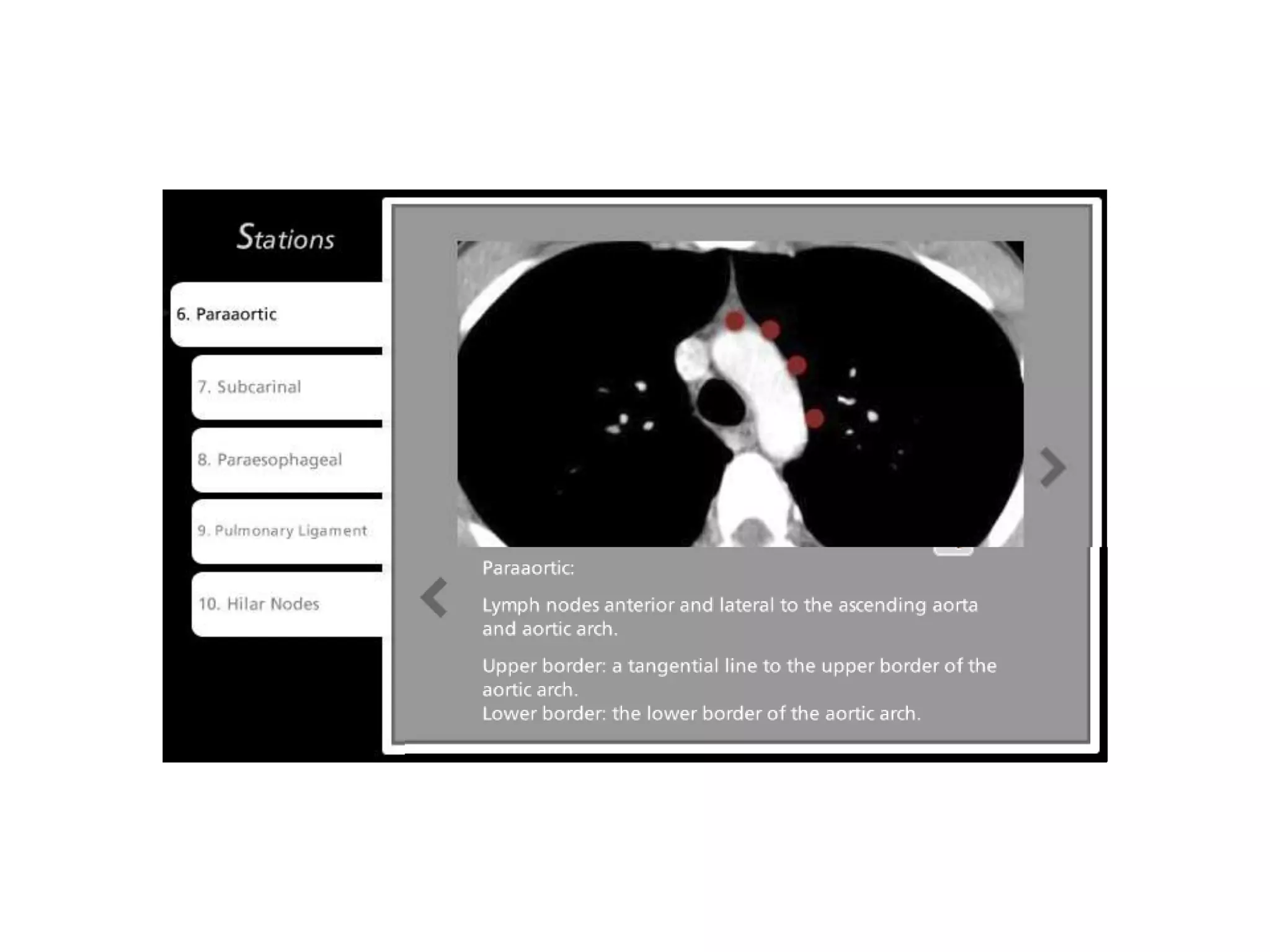 Lymph node anatomy for pet ct | PPT