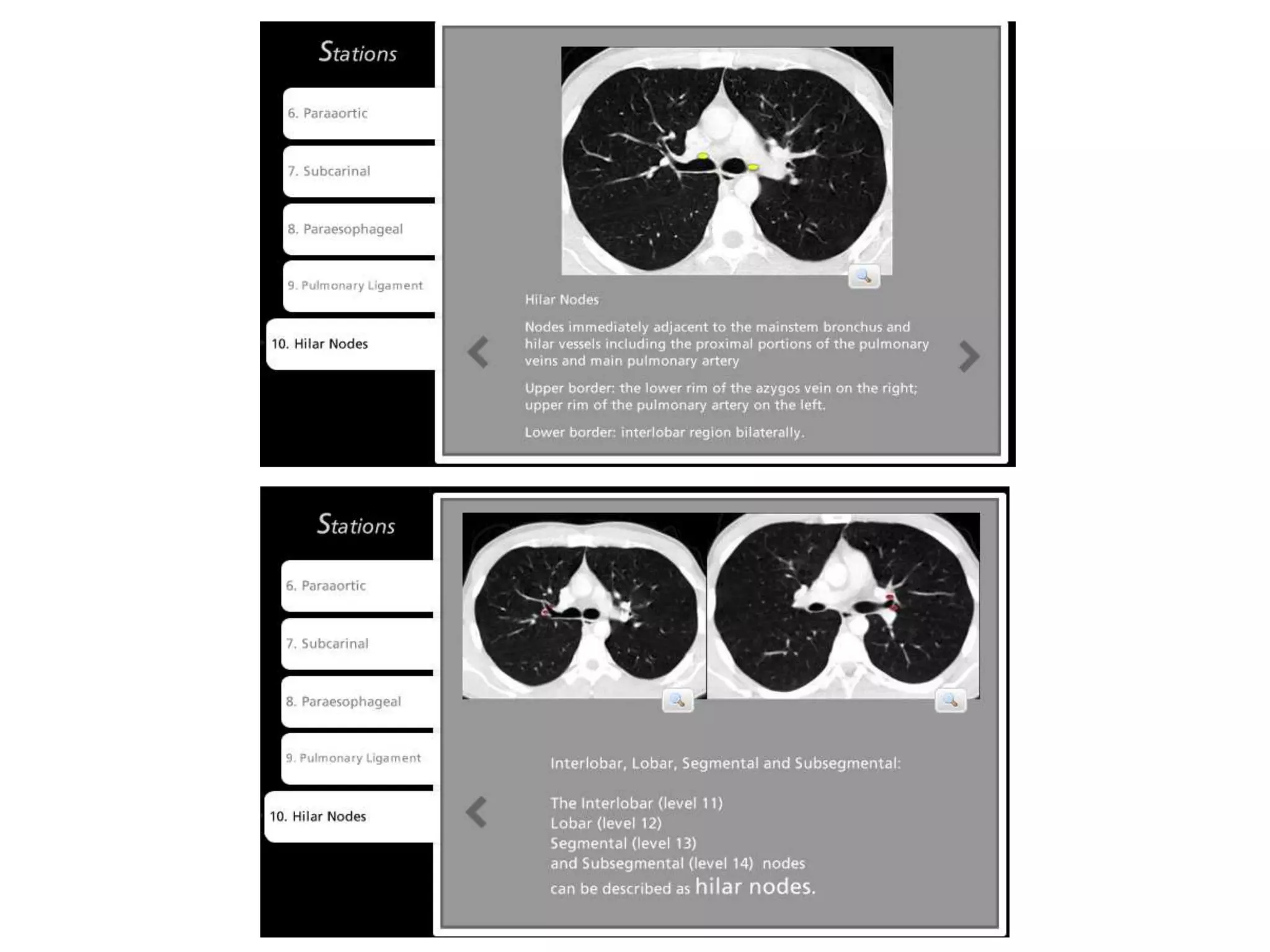 Lymph node anatomy for pet ct | PPT