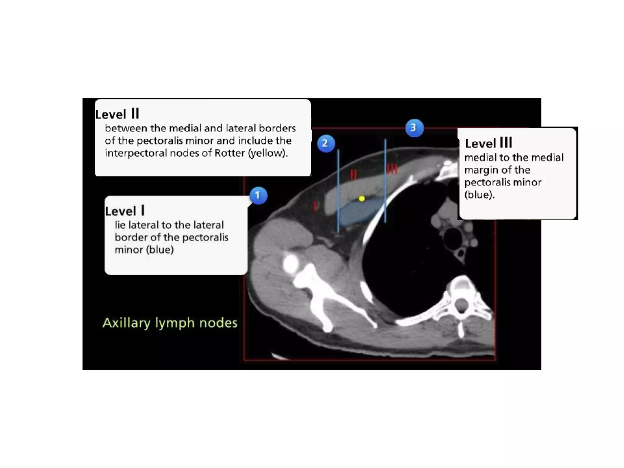 Lymph node anatomy for pet ct | PPT