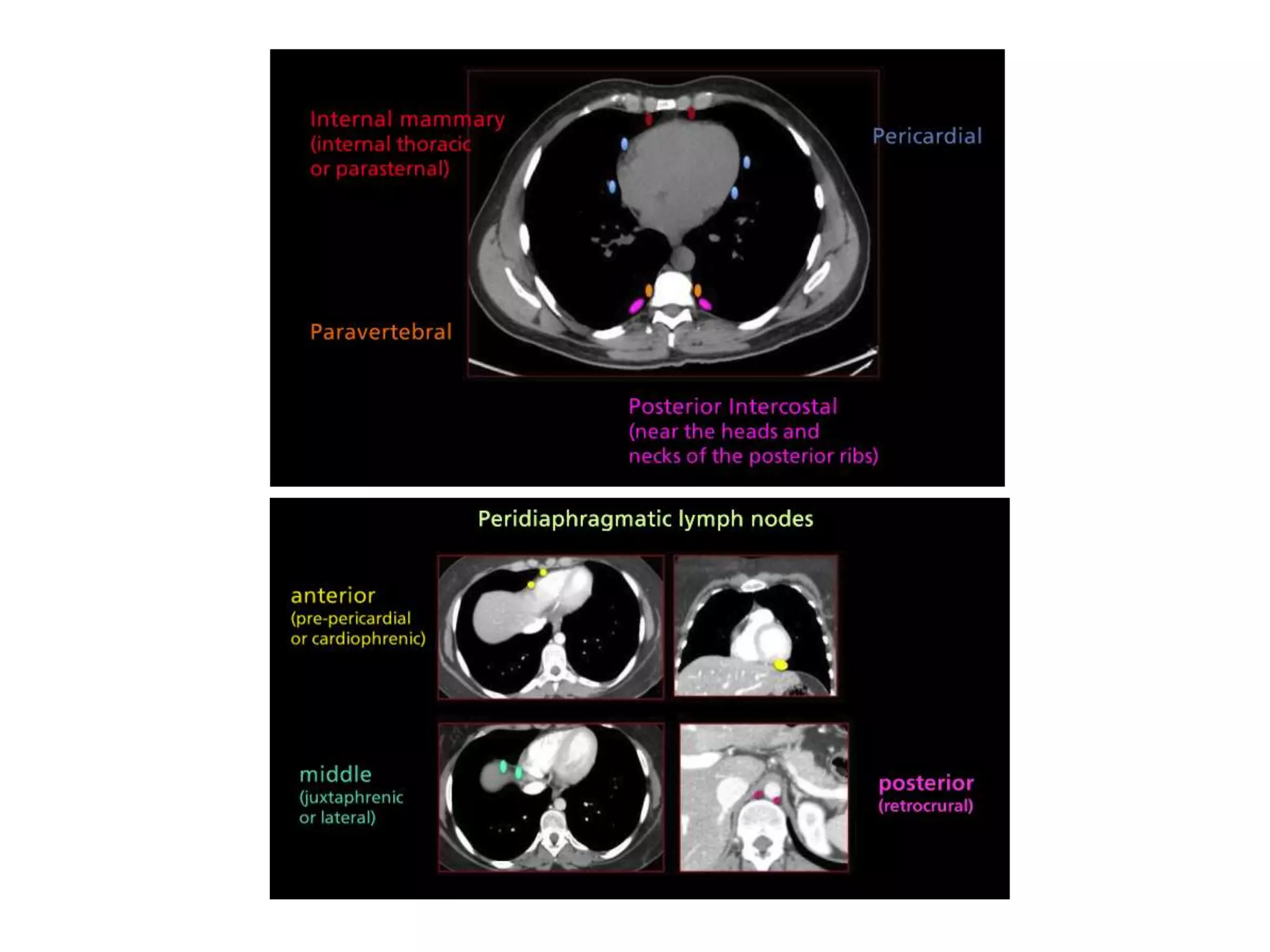 Lymph node anatomy for pet ct | PPT
