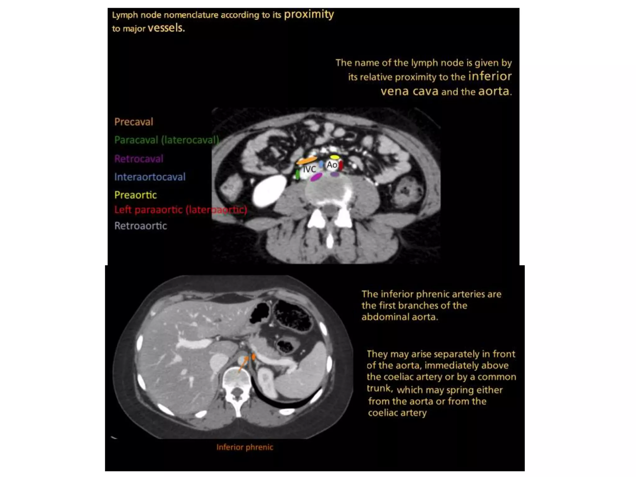 Lymph node anatomy for pet ct | PPT