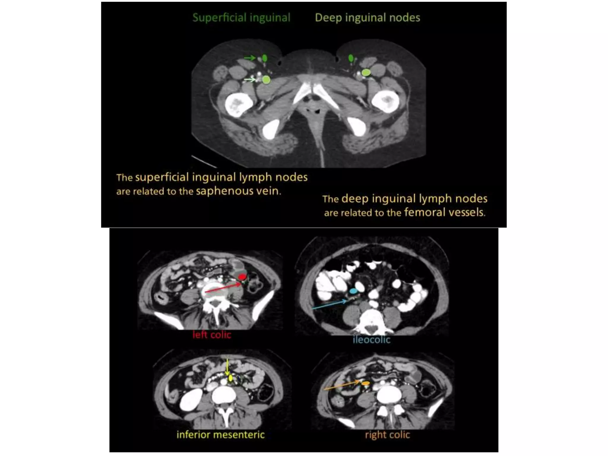 Lymph node anatomy for pet ct | PPT