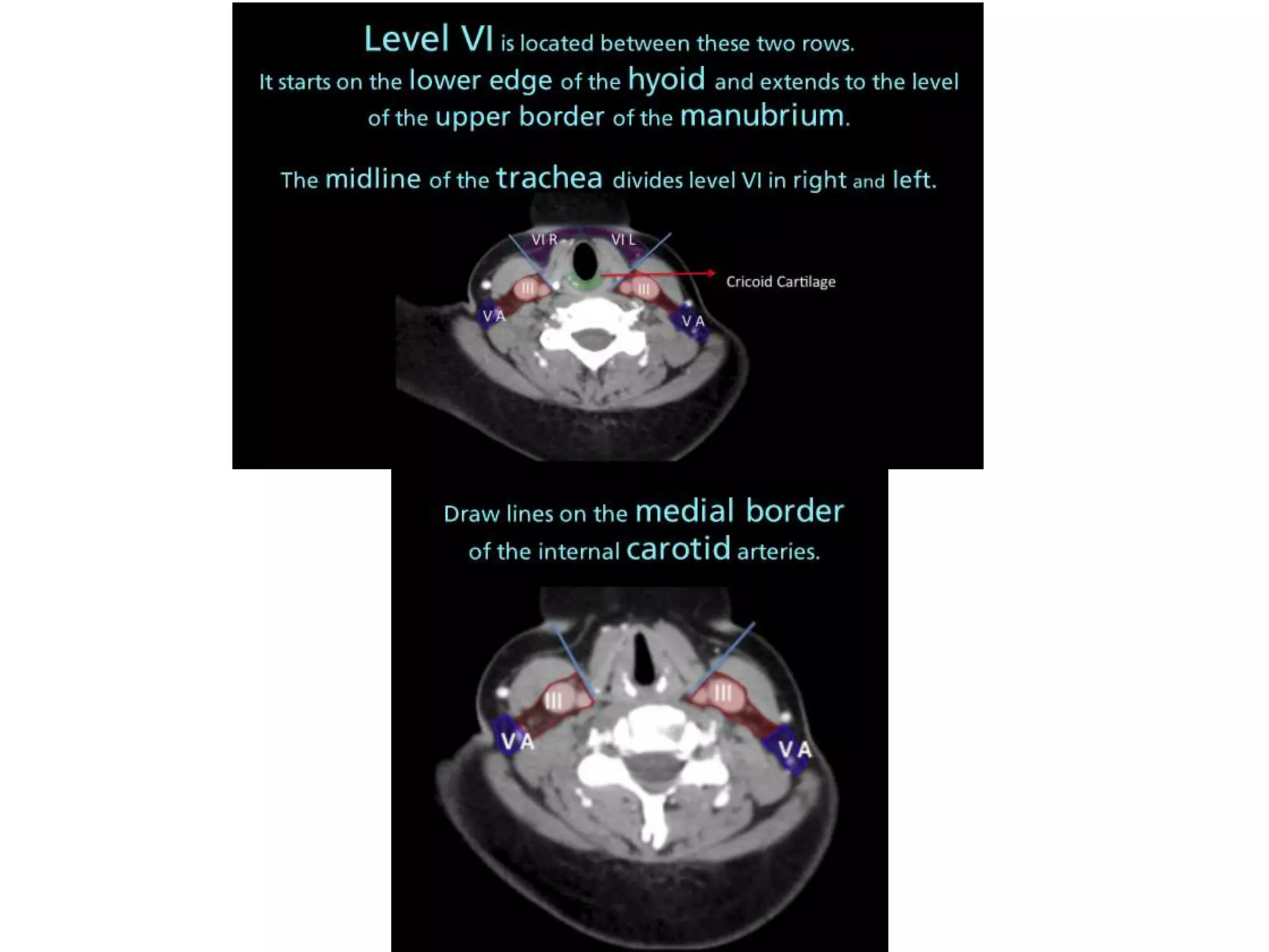 Lymph node anatomy for pet ct | PPT