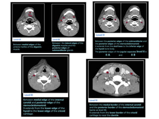 Lymph node anatomy for pet ct | PPT