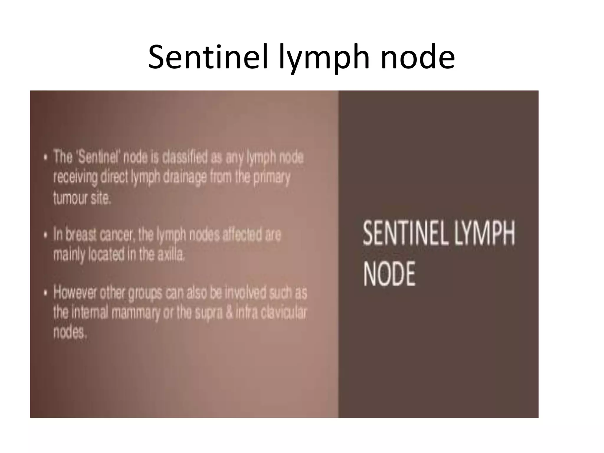 Lymph node biopsy | PPTX