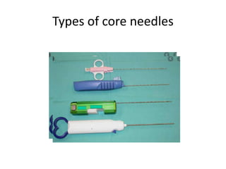 Lymph node biopsy | PPTX