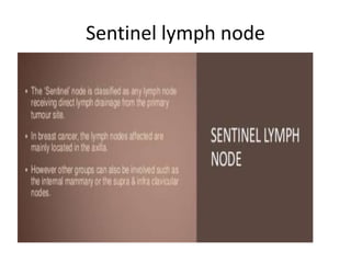 Lymph node biopsy | PPTX