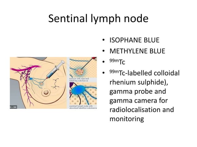 Lymph Node Biopsy Ppt