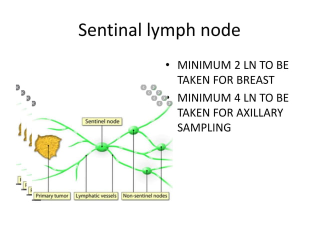 Lymph node biopsy | PPTX