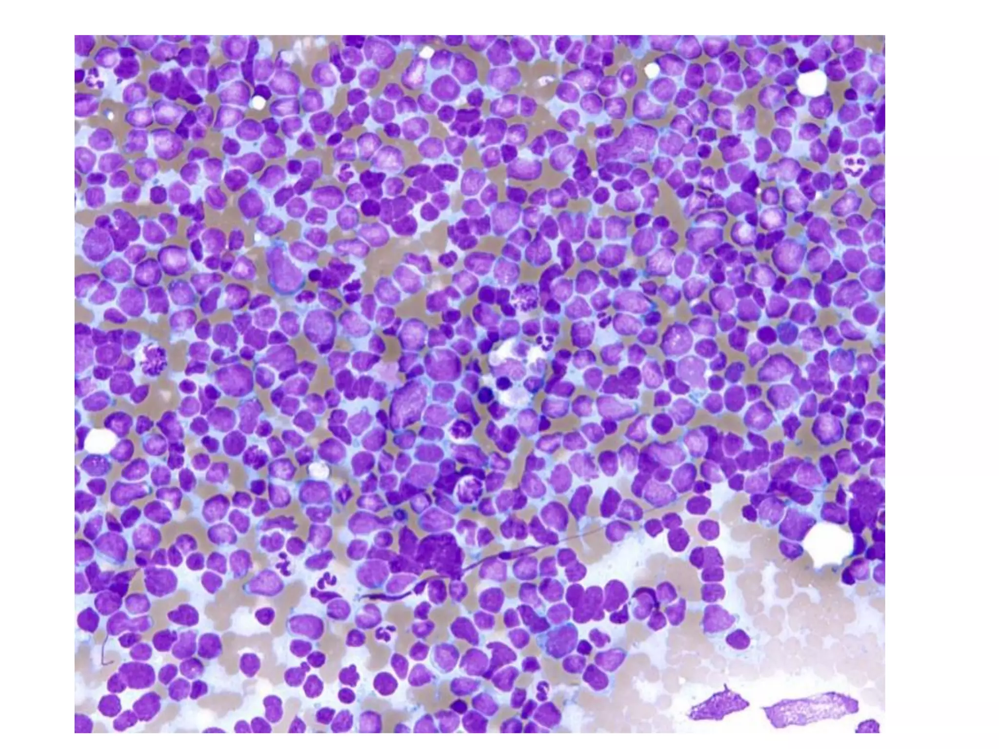 Lymph node cyto Ameli 26-03-1401_230413_085432.pdf