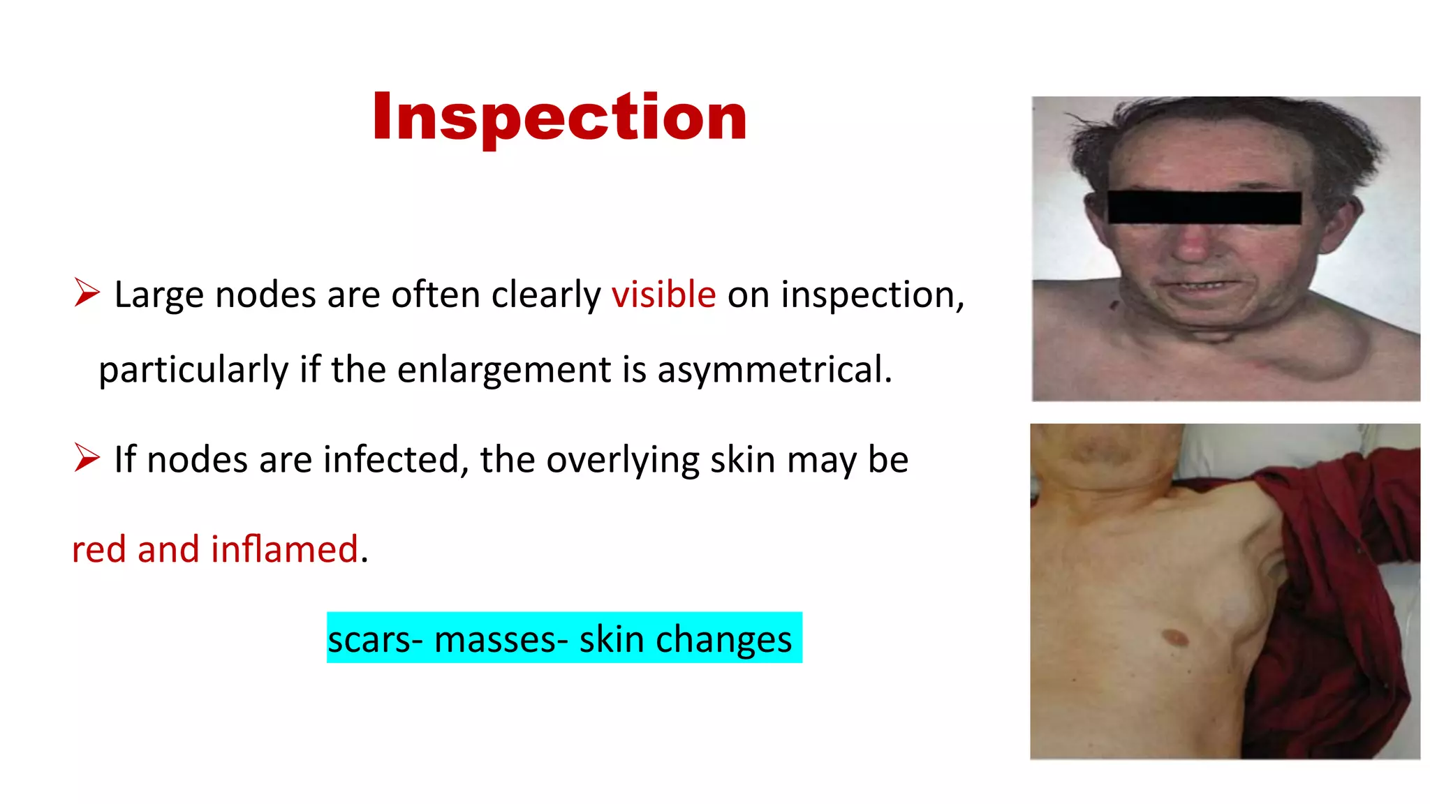 Lymph nodes examination | PPTX