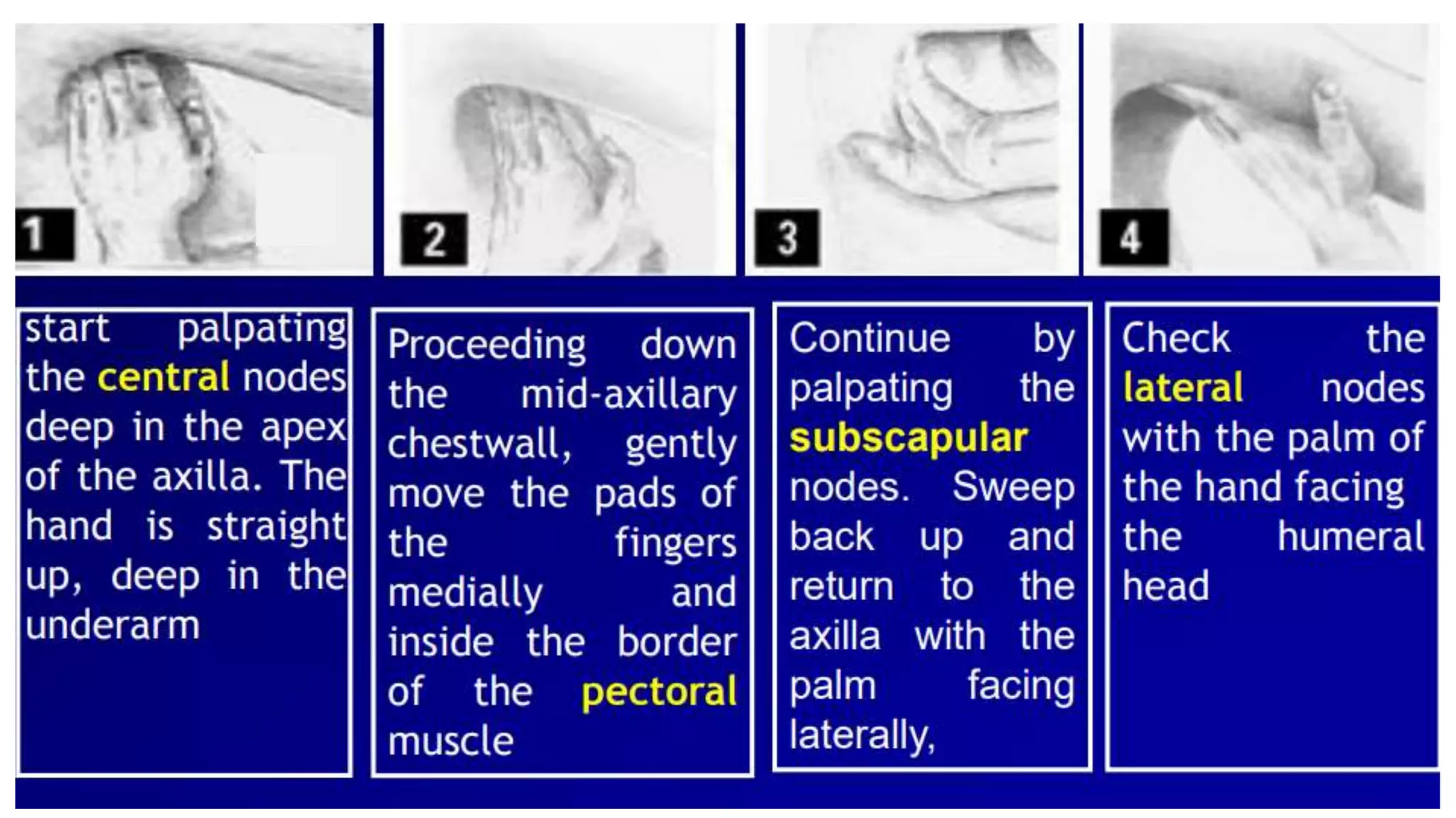 Lymph nodes examination | PPTX