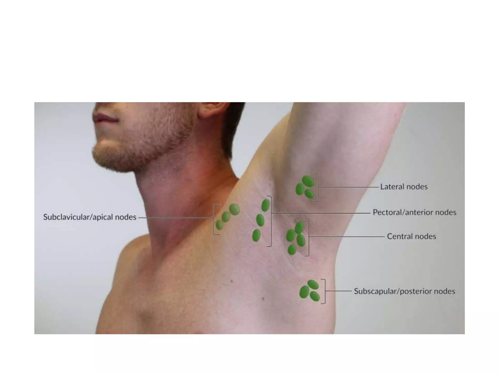 Lymph node, Lump, & Ulcer Examination.pptx