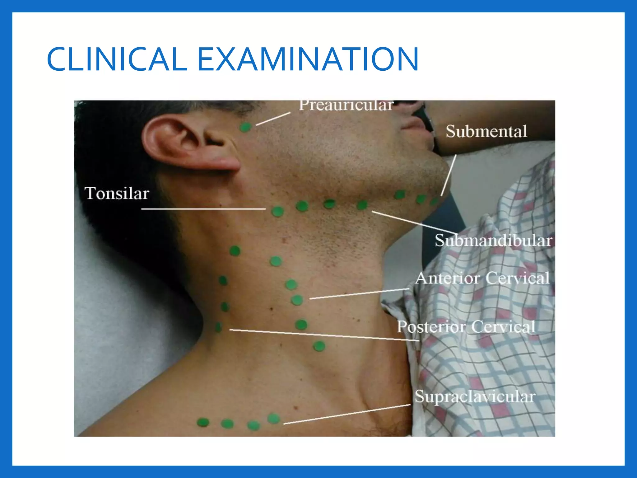 Histology and pathology of lymph nodes | PPTX