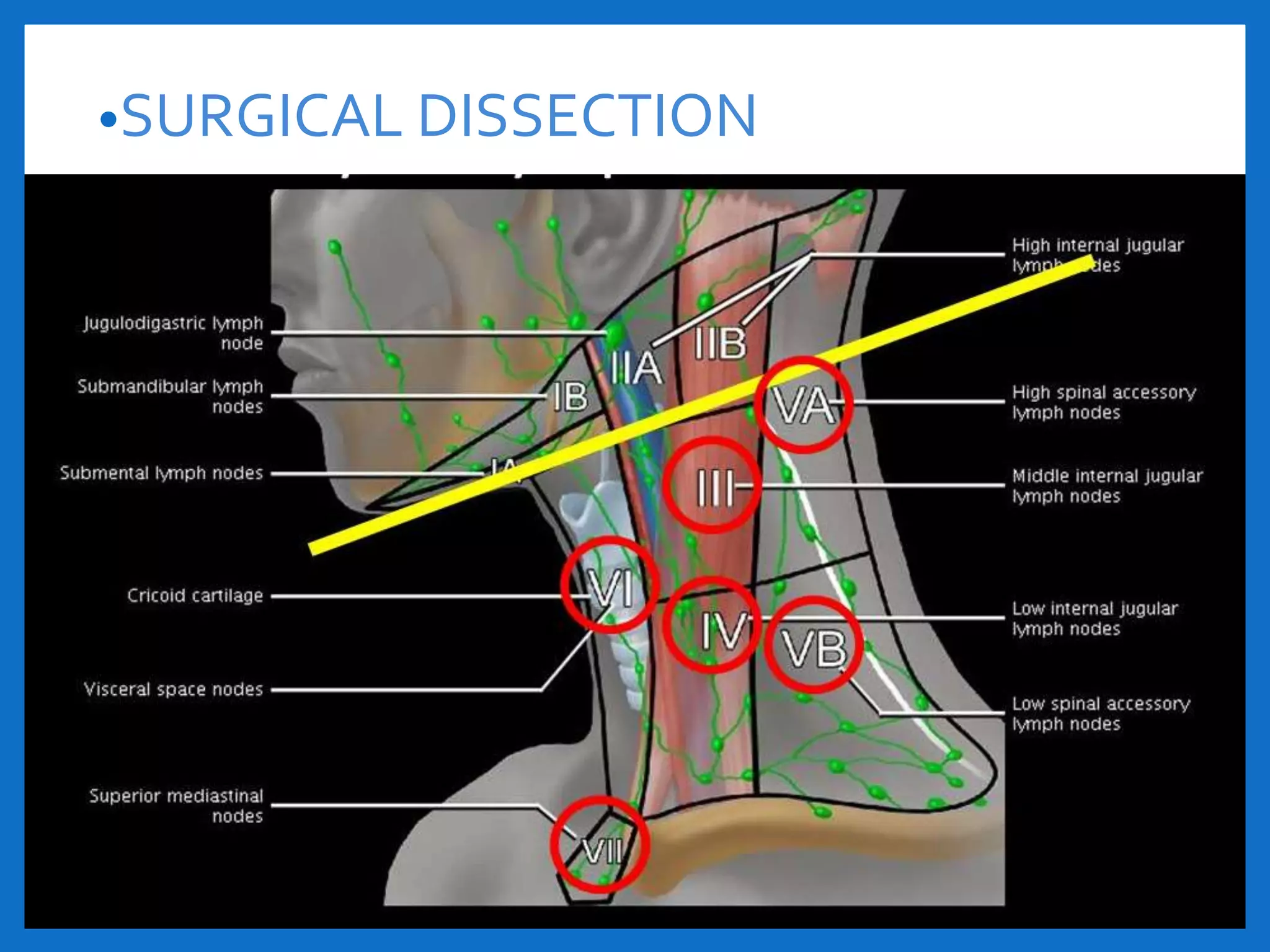 Histology and pathology of lymph nodes | PPTX
