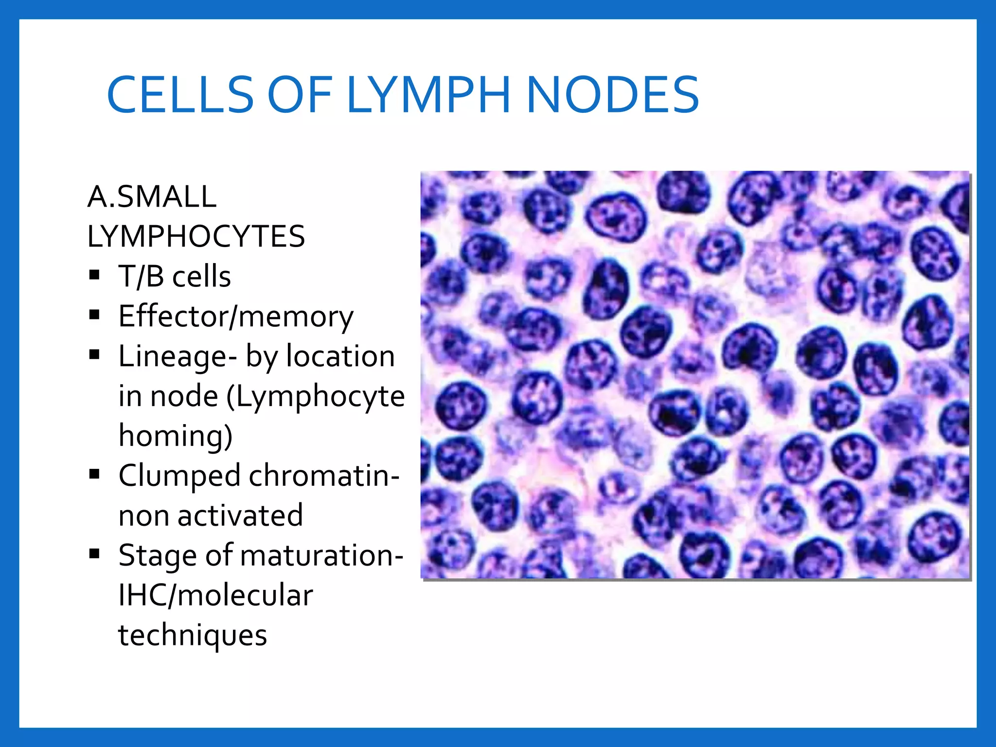 Histology and pathology of lymph nodes | PPTX