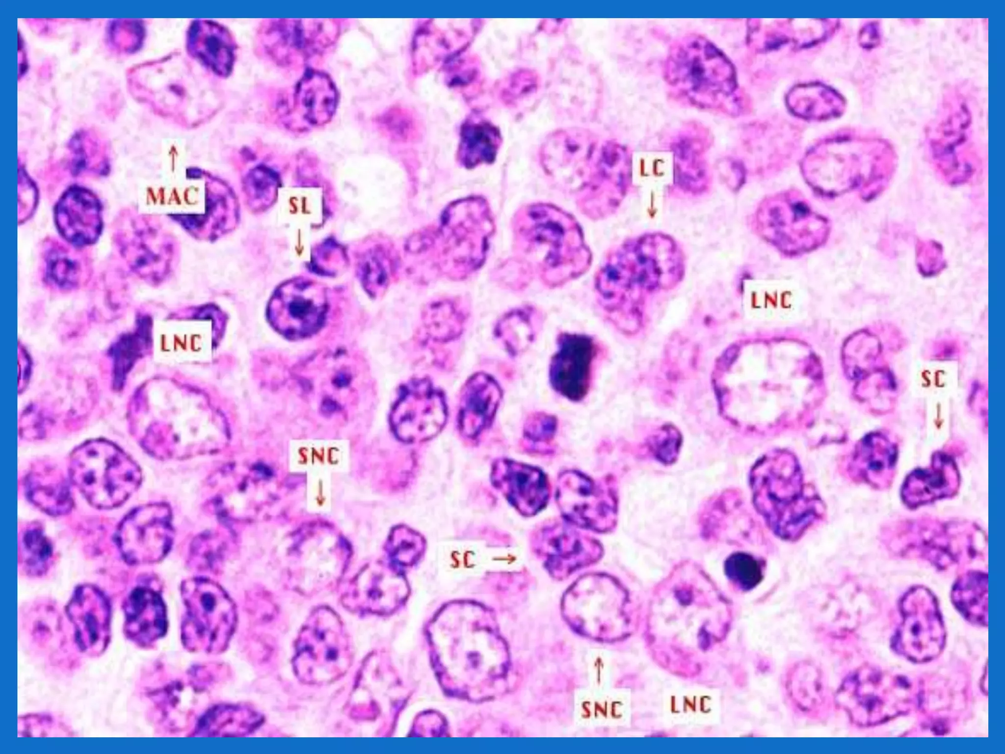 Histology and pathology of lymph nodes | PPTX