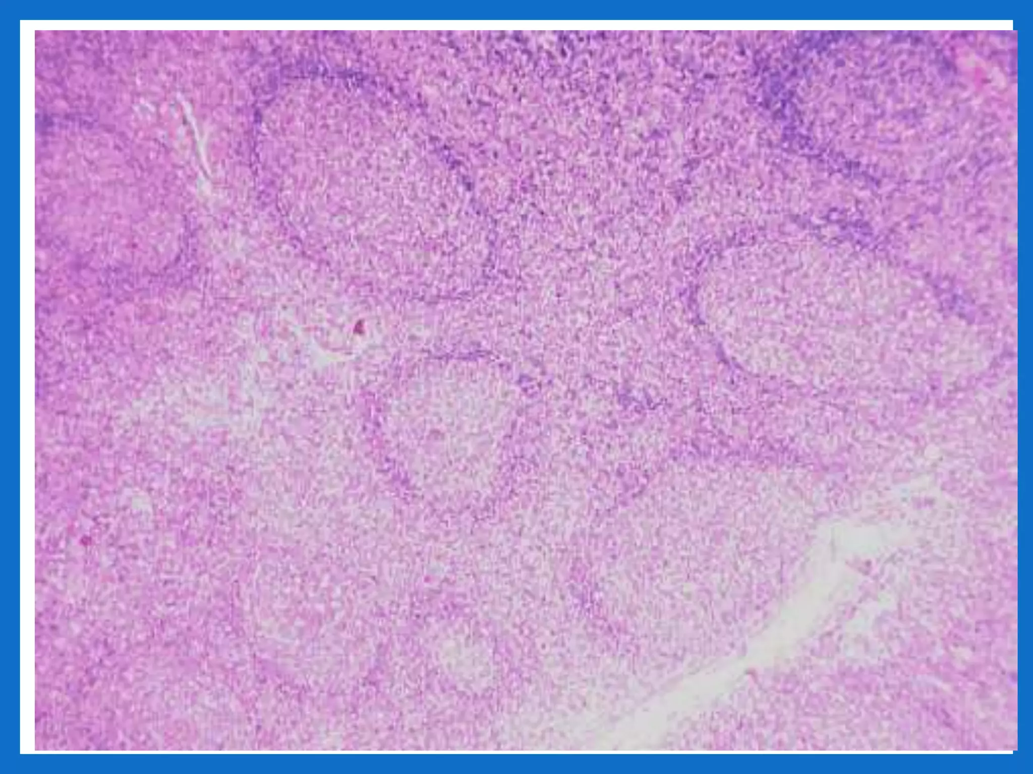 Histology and pathology of lymph nodes | PPTX | Biological Sciences ...