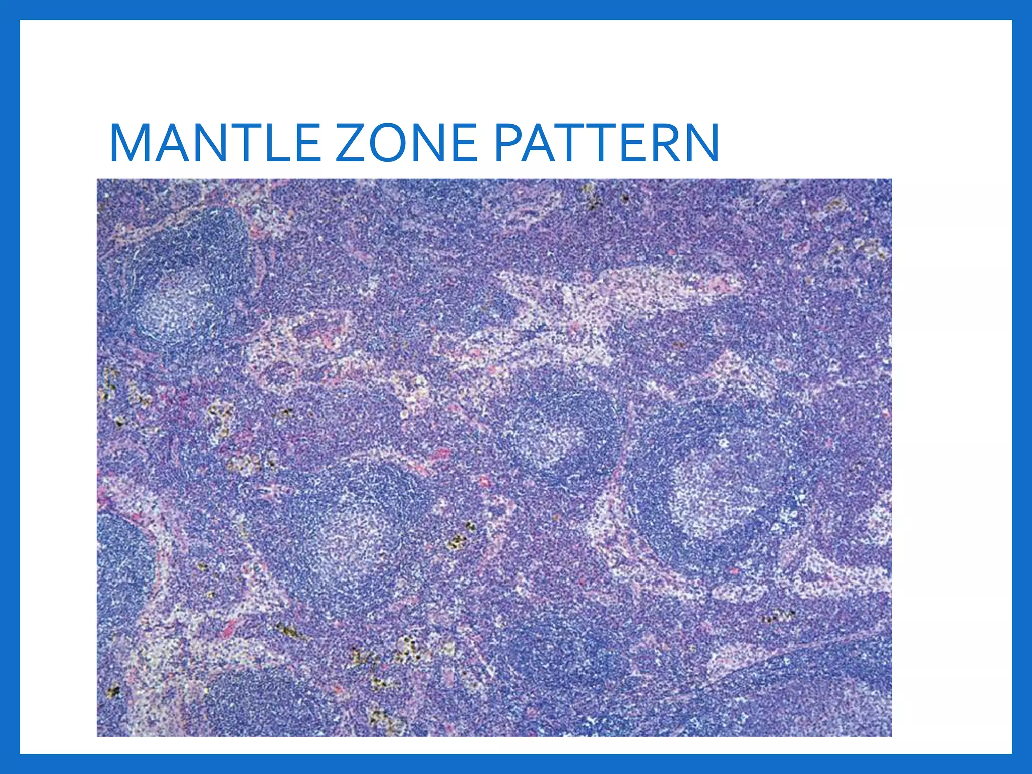 Histology and pathology of lymph nodes | PPTX