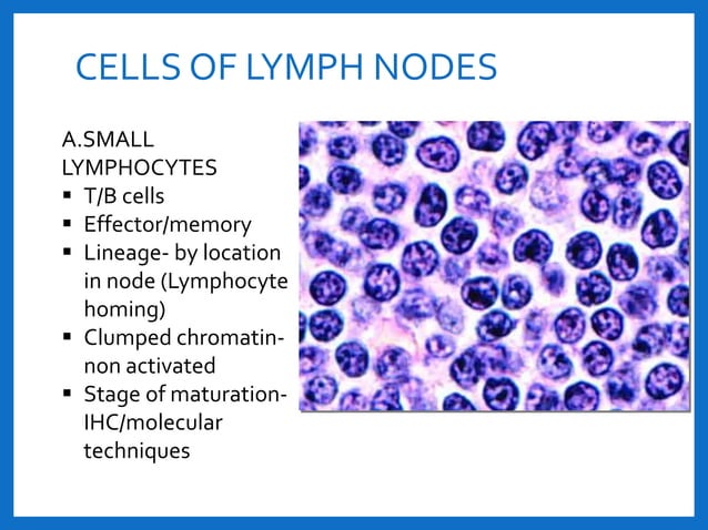 Histology and pathology of lymph nodes | PPTX | Biological Sciences ...