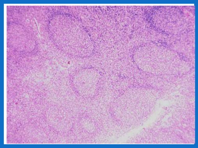 Histology and pathology of lymph nodes | PPTX | Biological Sciences ...