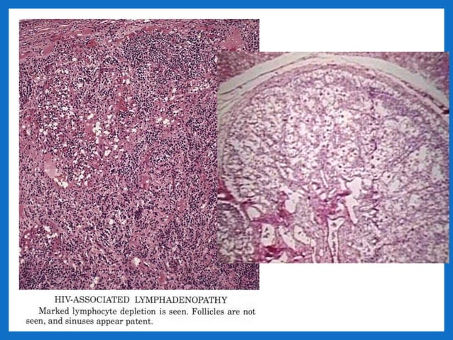Histology and pathology of lymph nodes | PPTX | Biological Sciences ...