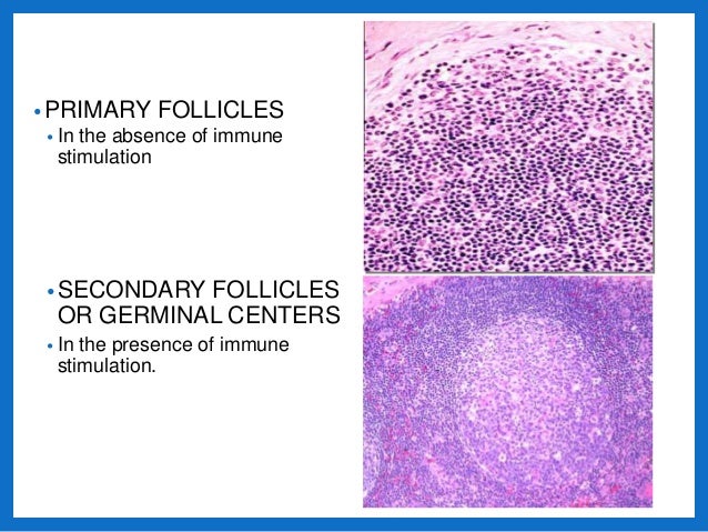 Histology and pathology of lymph nodes