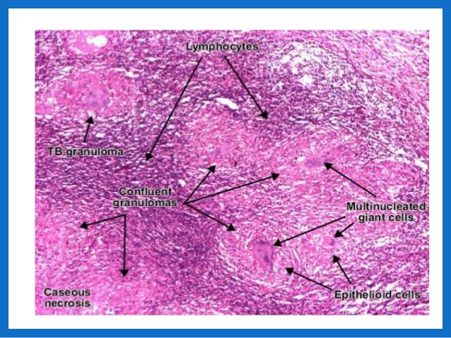 Histology and pathology of lymph nodes