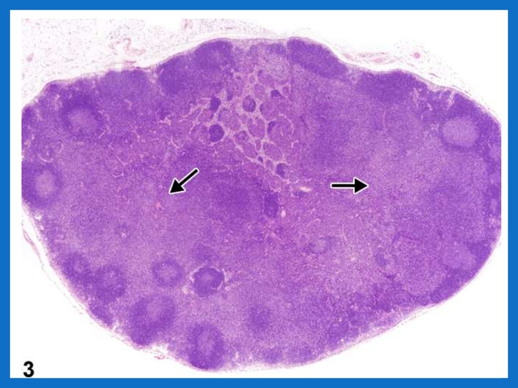 Normal Histology Of Lymph Node
