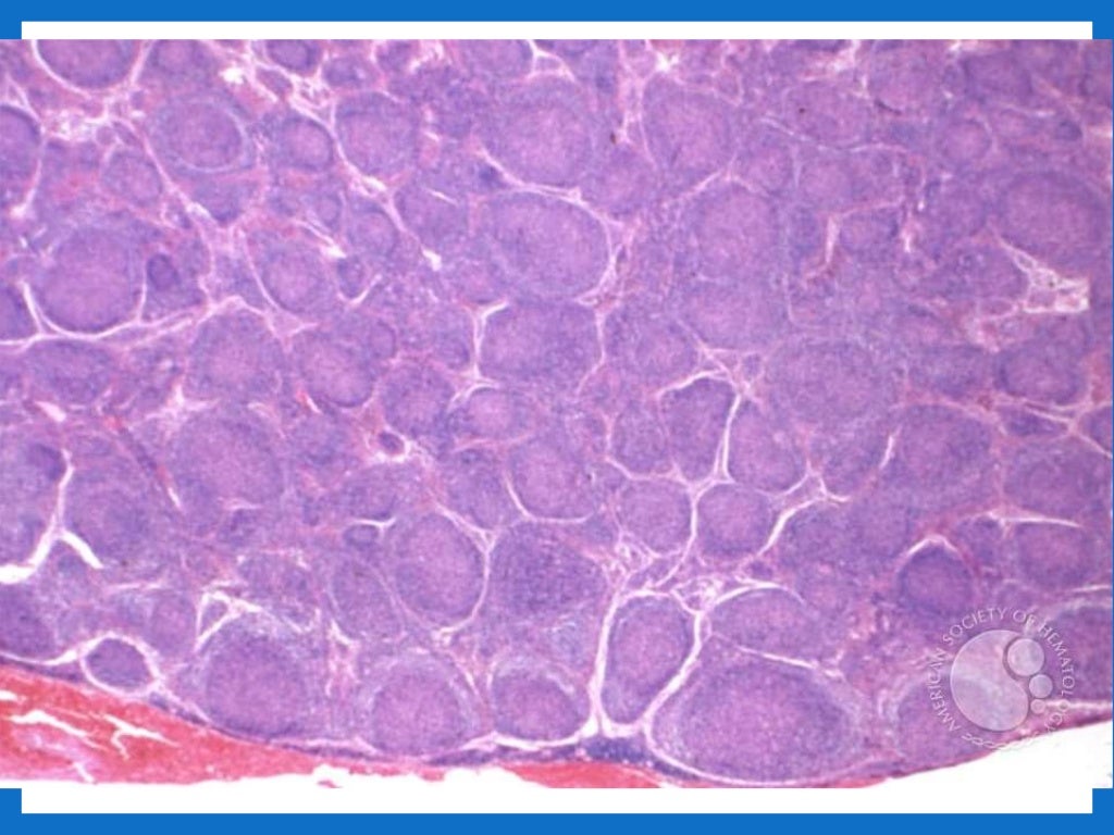 Histology Lymph Node Lymph Node Histology Slides Lymph Nodes Images ... Histology Lymph Node Lymph Node Histology Slides Lymph Nodes Images ...