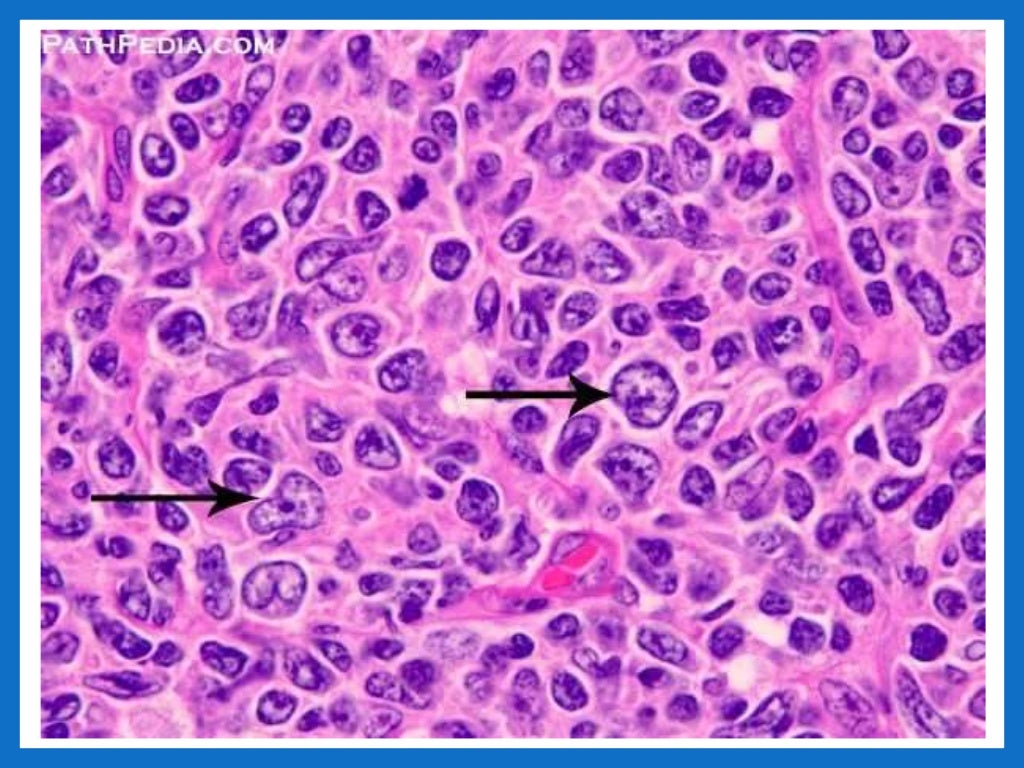 Histology and pathology of lymph nodes