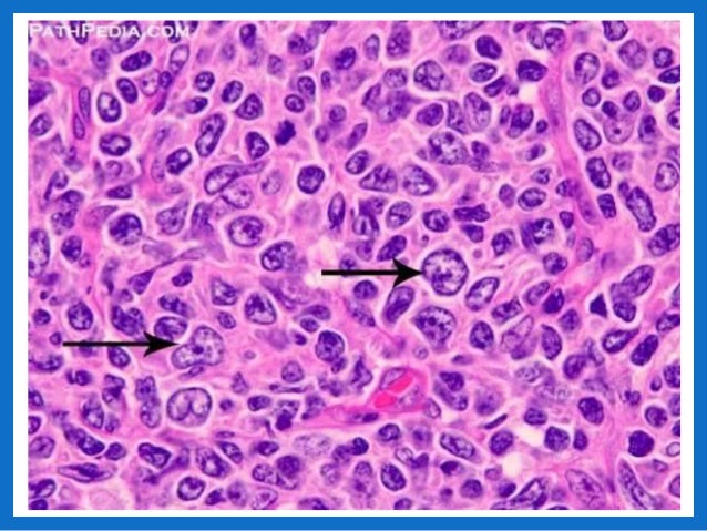 Histology and pathology of lymph nodes